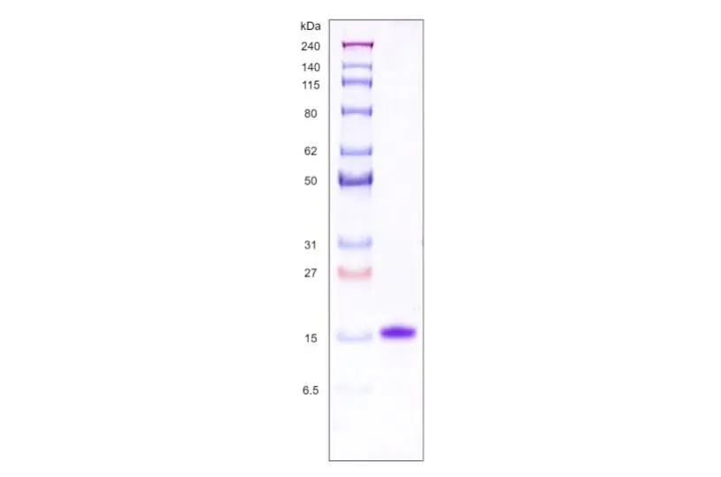 Recombinant Human Galectin 1, His Tag -100 ug | Axis Shield Density Gradient Media
