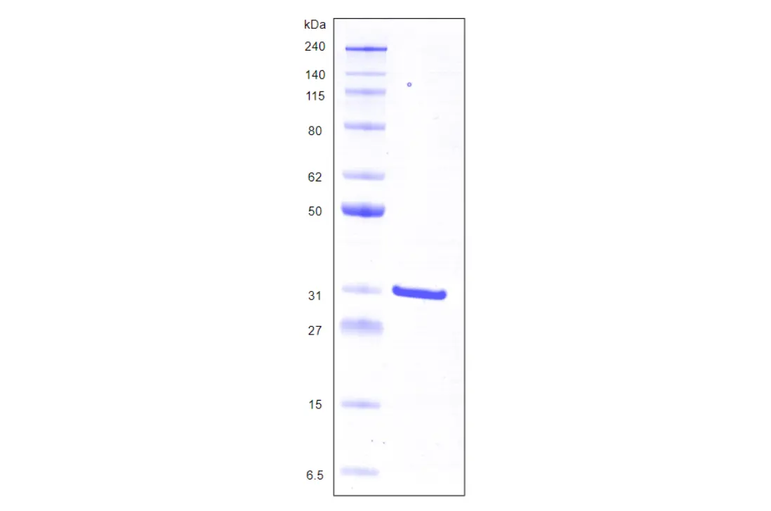 Recombinant Human Galectin 3, His Tag -100 ug | Axis Shield Density Gradient Media