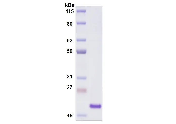 Recombinant Human Siglec-9, His Tag -25 ug | Axis Shield Density Gradient Media